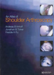 Buy Atlas of Shoulder Arthroscopy Book Online at Low Prices in India ...