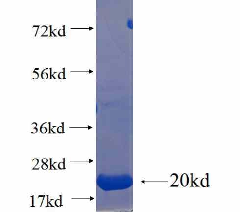 Amazon.com: Human Histone H2B Fusion Protein : Industrial & Scientific