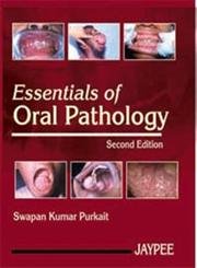 Essentials of Oral Pathology: Amazon.co.uk: 9788180611506: Books