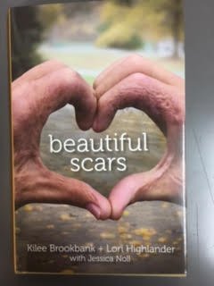 Amazon.fr - Beautiful Scars - Livres