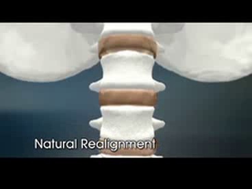 Watch Teeter Hang Ups F5000 Inversion Table on Amazon Live