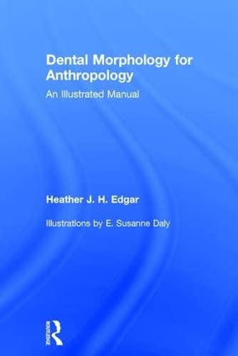 Dental Morphology for Anthropology: An Illustrated Manual: Amazon.co.uk ...
