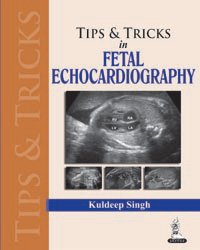 TIPS & TRICS IN FETAL ECHOCARDIOGRAPHY: Kuldeep Singh: 9789350909607 ...