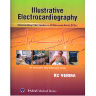Buy Illustrative Electrocardiography Book Online at Low Prices in India ...