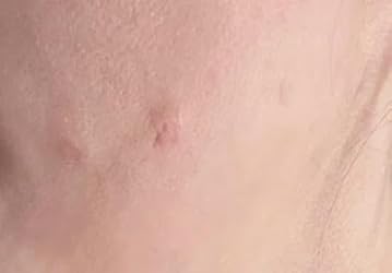 Amazon.com : Scarguard - Invisible Brush-On Silicone Sheet with Vitamin ...