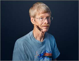 Dissecting the Schmidt Sting Pain Index - Discussing Venomous Insects ...