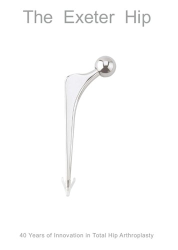 The Exeter Hip: 40 Years of Innovation in Total Hip Arthroplasty ...