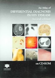 Atlas of HIV Disease: 9781842142905: Medicine & Health Science Books ...