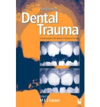 Handbook of Dental Trauma: A Practical Guide to the Treatment of Trauma ...