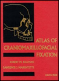 Atlas of Craniomaxillofacial Fixation: 9780781700160: Medicine & Health ...
