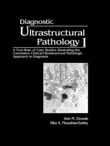 Amazon | Diagnostic Ultrastructural Pathology, Volume I: A Text-Atlas ...