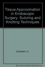 Buy Tissue Approximation in Endoscopic Surgery: Suturing and Knotting ...