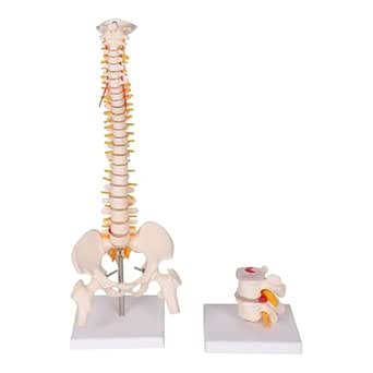 MINI Spine Model with VERTEBRAE Degeneration (Model): Amazon.com ...