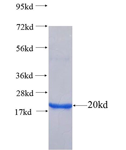 Amazon.com: Human F11R Fusion Protein : Industrial & Scientific