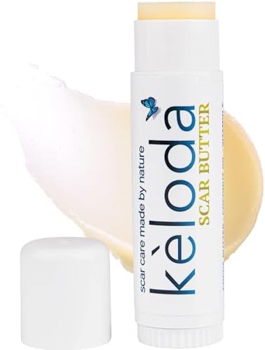 Amazon.com : Keloid Bump Removal, Scar Treatment Cream, Silicone Acne ...