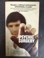 Psychic Surgery: Tom Valentine: 9780671789718: Amazon.com: Books