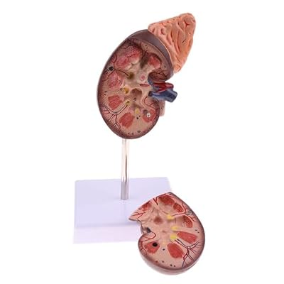 Kidney Anatomy Model, Life Size Kidney Anatomically Barbados | Ubuy