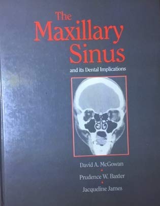 The Maxillary Sinus and Its Dental Implications: 9780723608134 ...