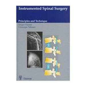 Instrumented Spinal Surgery: Principles and Technique : Amazon.in: Books