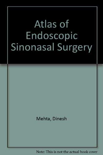 Atlas of Endoscopic Sinonasal Surgery: 9780812114713: Medicine & Health ...