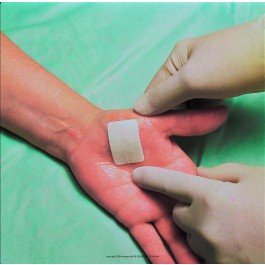 3M 3584 Tegaderm and Pad, 2-3/8" x 4", Shape, (Pack of 50) : Amazon.ca ...