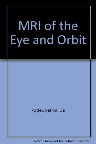 Amazon.fr - Mri of the Eye and Orbit - Potter, Patrick De, etc. - Livres