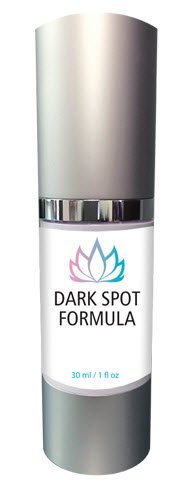 Amazon.com : Dark Spot Formula - Get Rid Of Under Eye Dark Circles (2 ...