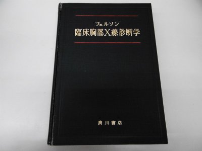 フェルソン臨床胸部X線診断学 (1977年) | Benjamin Felson, 石川 徹, 蜂屋 順一 |本 | 通販 | Amazon
