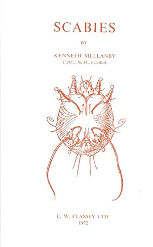 Scabies: Kenneth Mellanby: 9780900848612: Amazon.com: Books