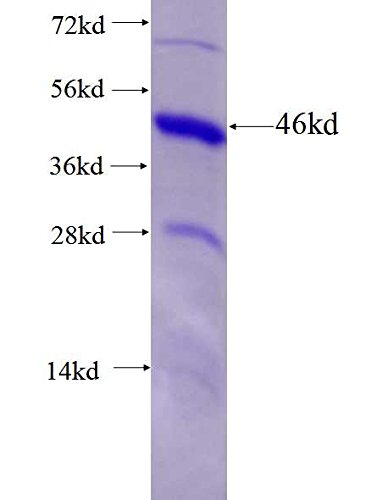 Amazon.com: Human DOCK4 Fusion Protein : Industrial & Scientific