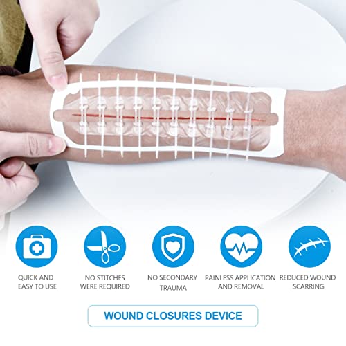 Snapklik.com : Large Butterfly Bandaids, Steri Strips Wound Closure ...