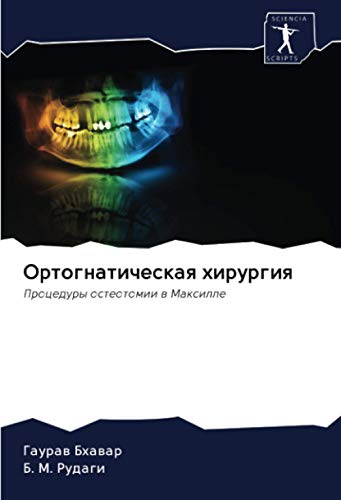 Maxille - Lexikon der Biologie