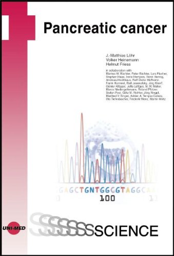 Amazon | Pancreatic Cancer (Uni-Med Science) | Lohr, J.-Matthias ...