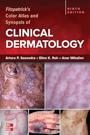 Fitzpatrick's Color Atlas and Synopsis of Clinical Dermatology, Ninth ...