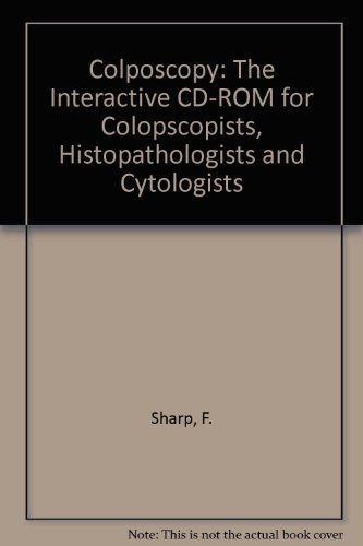 Buy Colposcopy: The Interactive CD-ROM for Colposcopists ...