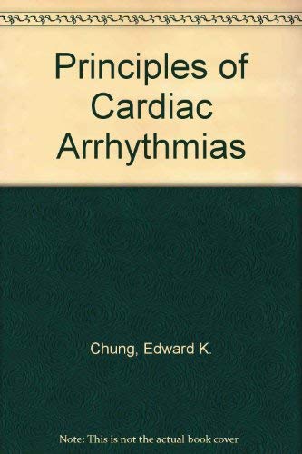 Principles of Cardiac Arrhythmias: 9780683015676: Books - Amazon.ca