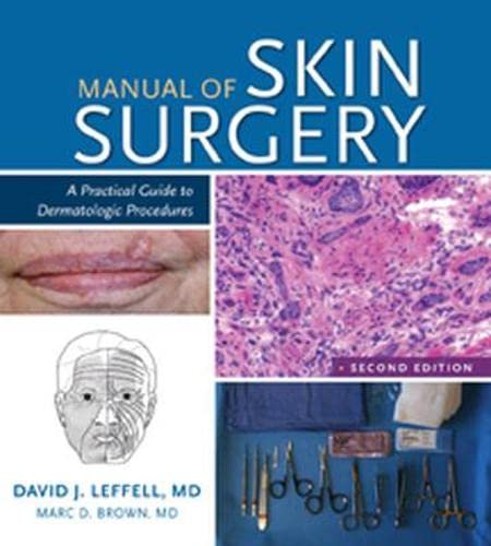 Manual of Skin Surgery: A Practical Guide to Dermatologic Procedures ...