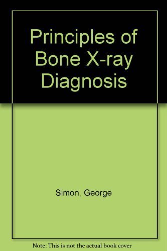Principles of bone X-ray diagnosis: Simon, George: 9780407363199 ...