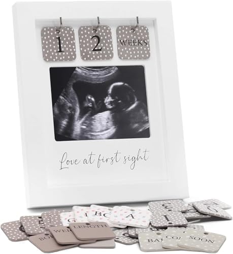 Amazon.com: Ultrasound Picture Frames W/ Free Digital Pregnancy Journal ...