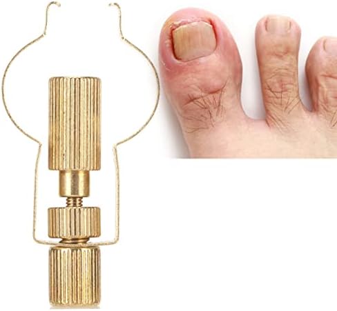 Amazon.com: Ingrown Toenail Lifter Foot Care Tool Toenail Clamp ...