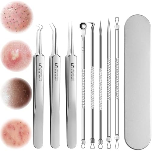 Amazon.com: Stainless Steel Blackhead Remover Kit, Pimple Popper Tool ...