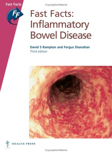 Inflammatory Bowel Disease: Fast Facts: Rampton, David S., Shanahan ...
