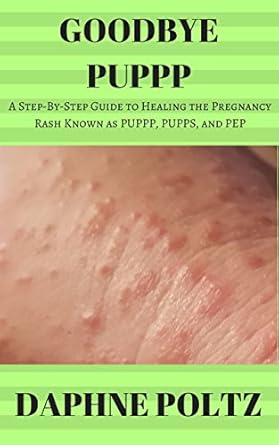 Goodbye PUPPP: A Step-by-Step Guide to Healing the Pregnancy Rash Known ...