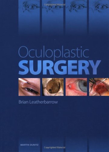 Oculoplastic Surgery: 9781853179426: Medicine & Health Science Books ...