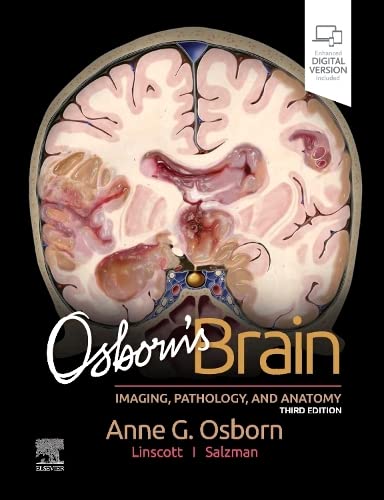 Osborn's Brain: Imaging, Pathology, and Anatomy : Osborn MD FACR, Anne ...