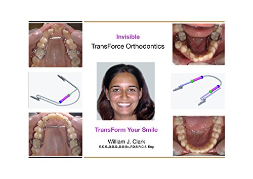 Amazon.com: TransForce Orthodontics: Invisible Braces (New Horizons in ...