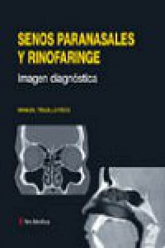 Senos paranasales y rinofaringe. Imagen diagnóstica : Amazon.co.uk: Books