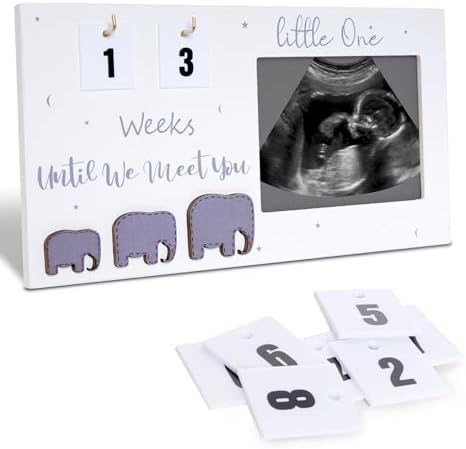 Amazon.com: Sucrain Sonogram Picture Frame, Standard 4" x 3" Ultrasound ...