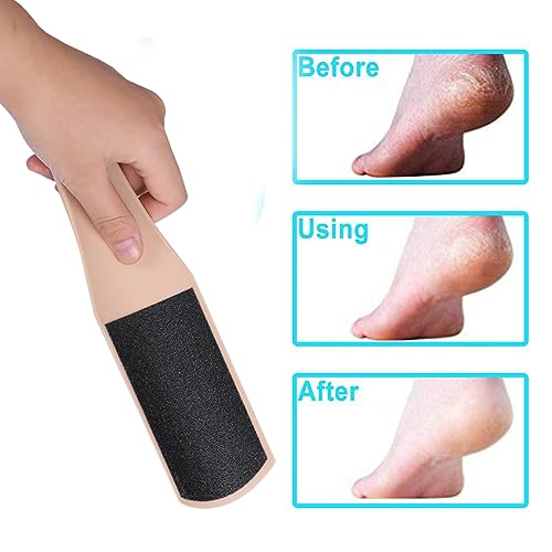 Snapklik.com : 3 Pcs U-Shape Professional Pedicure Dead Skin Foot Files ...