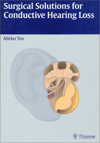 Amazon | Surgical Solutions for Conductive Hearing Loss | Tos, Mirko ...